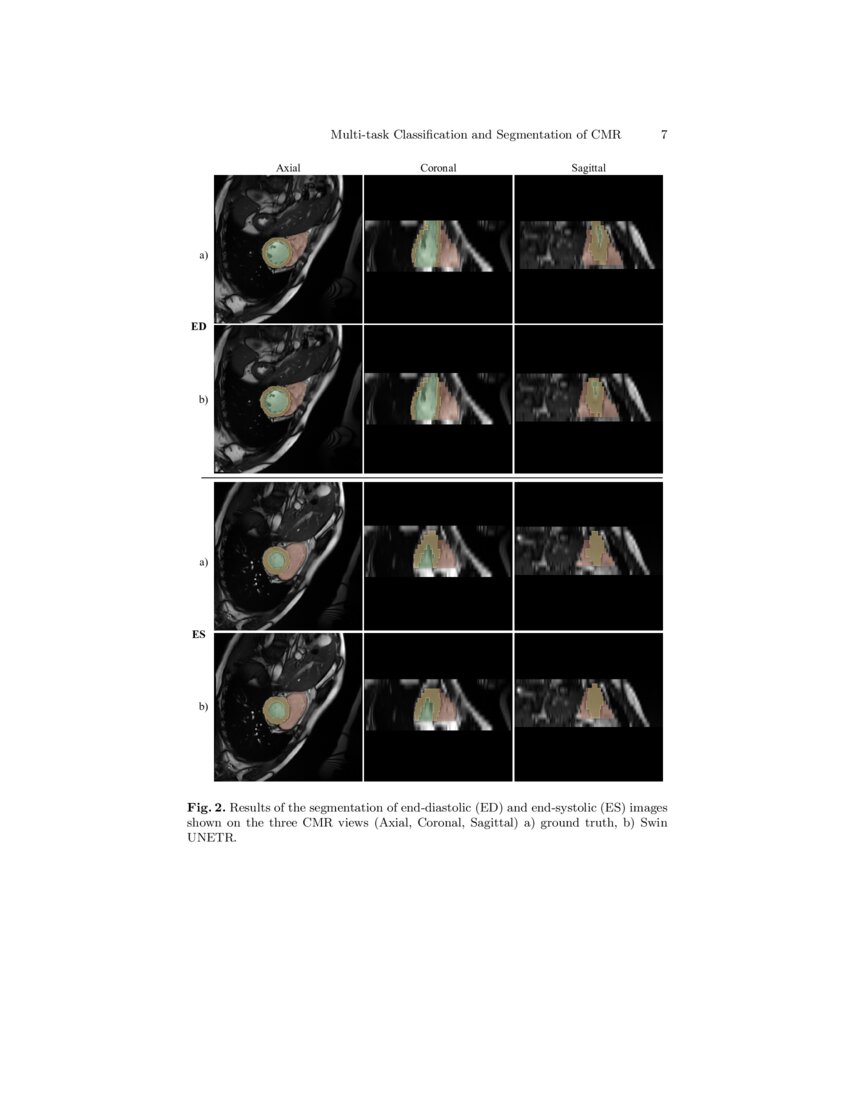 Multi Task Swin Transformer For Motion Artifacts Classification And Cardiac Magnetic Resonance