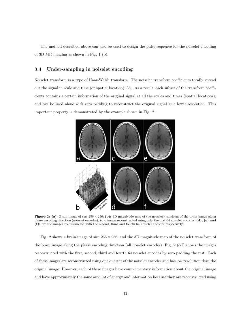 Multichannel Compressive Sensing MRI Using Noiselet Encoding | DeepAI