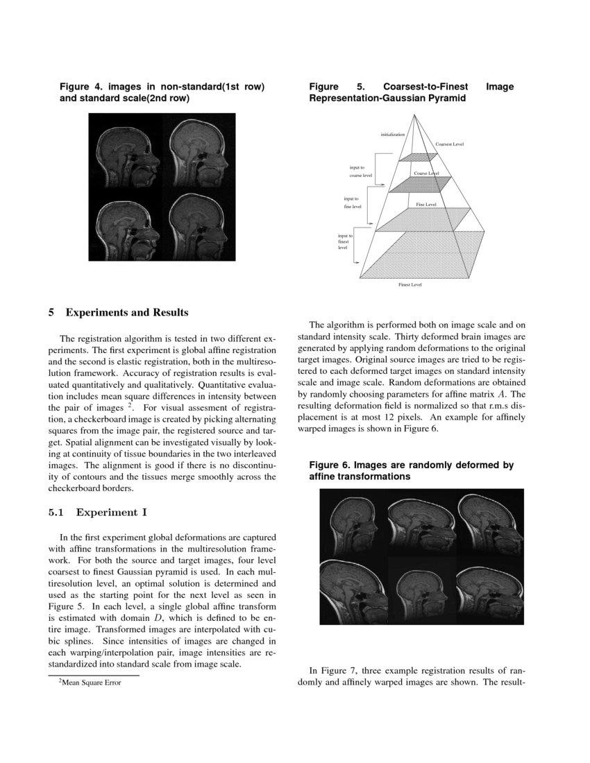 Multiresolution Elastic Medical Image Registration in Standard ...