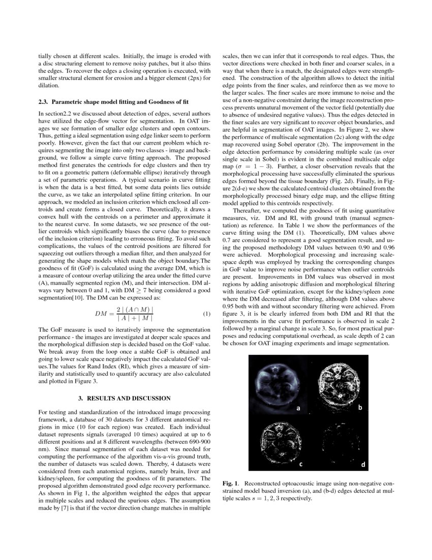 Multiscale Edge Detection And Parametric Shape Modeling For Boundary