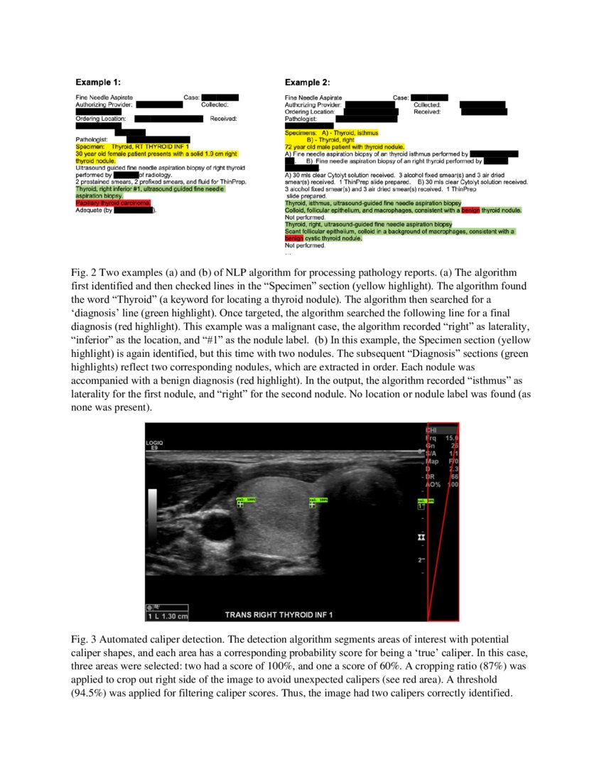 Multistep Automated Data Labelling Procedure (MADLaP) for Thyroid Nodules on Ultrasound: An ...
