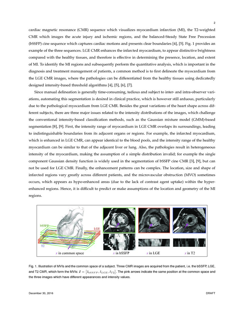 Multivariate Mixture Model For Myocardium Segmentation Combining Multi