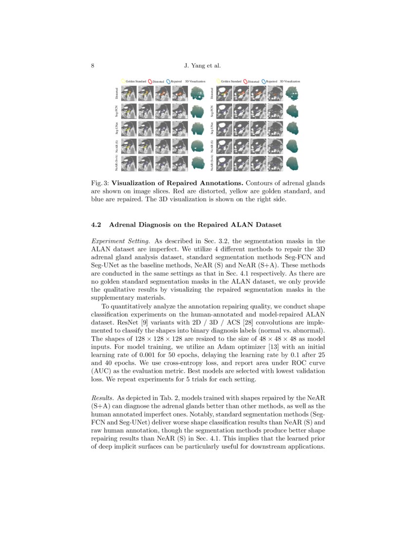 Neural Annotation Refinement: Development of a New 3D Dataset for Adrenal Gland Analysis | DeepAI