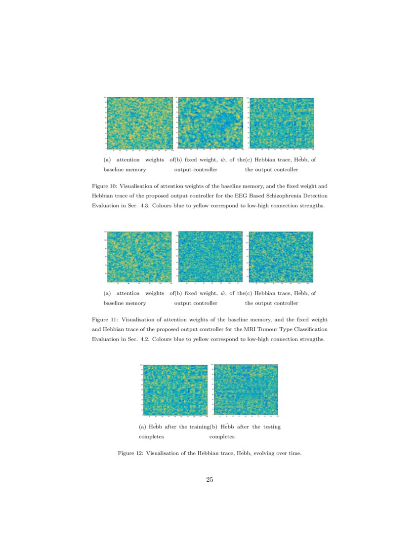 Neural Memory Plasticity for Anomaly Detection | DeepAI
