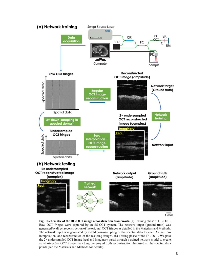 Neural network-based image reconstruction in swept-source optical coherence tomography using ...