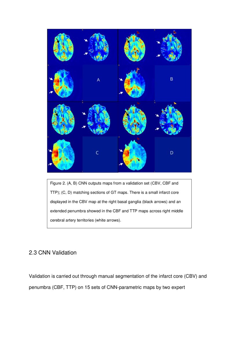 Neural Network-derived perfusion maps: a Model-free approach to computed tomography perfusion in ...