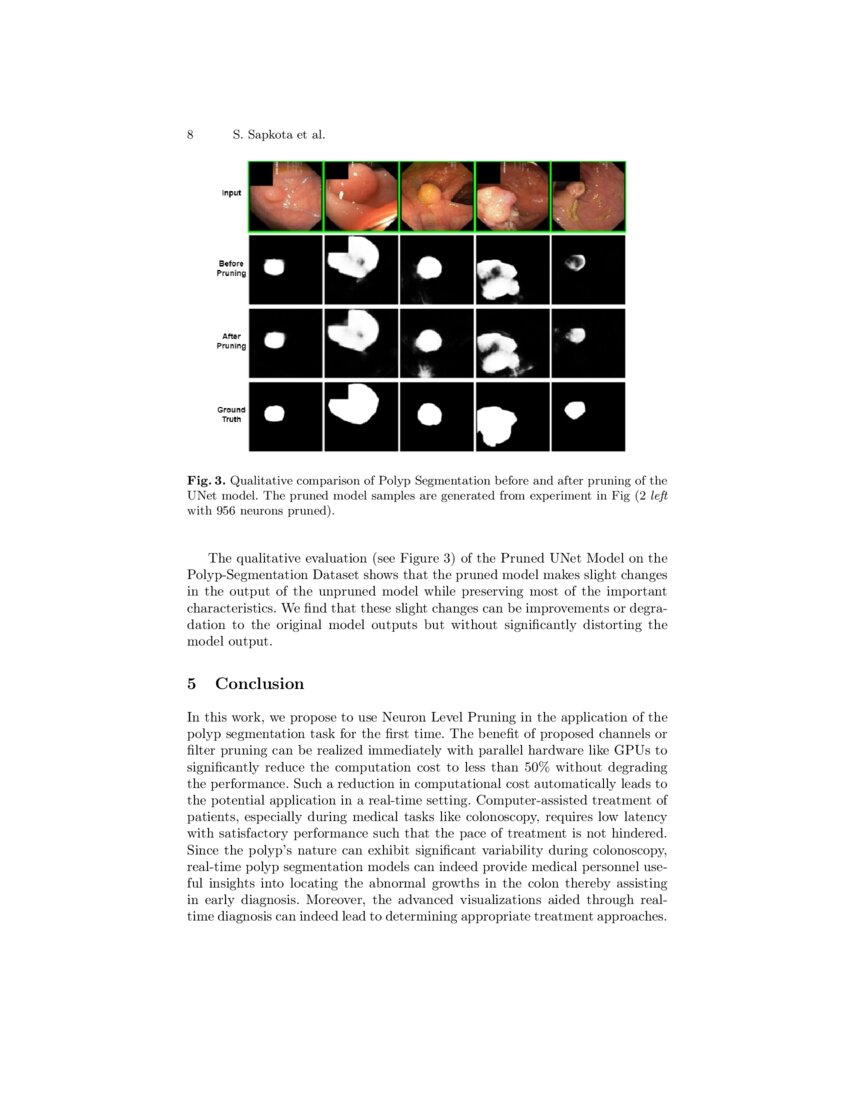 Neural Network Pruning for Real-time Polyp Segmentation | DeepAI