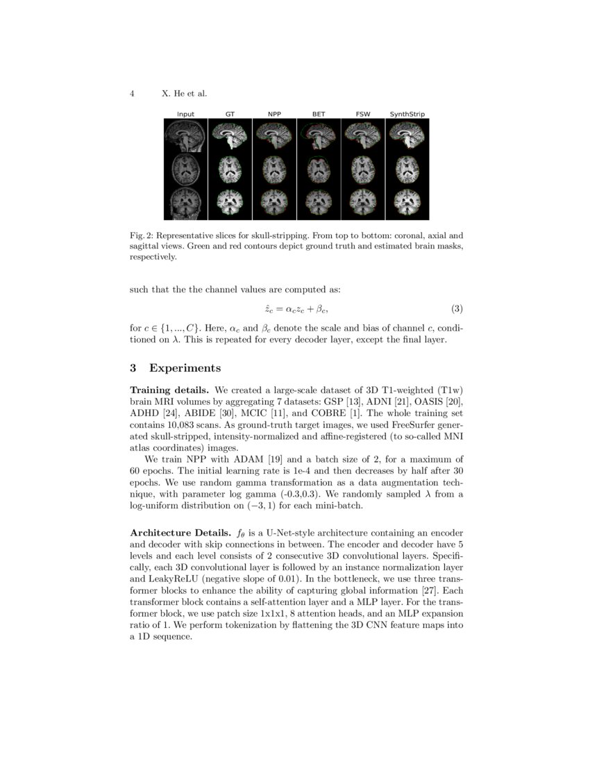 Neural Pre Processing A Learning Framework For End To End Brain Mri 9341