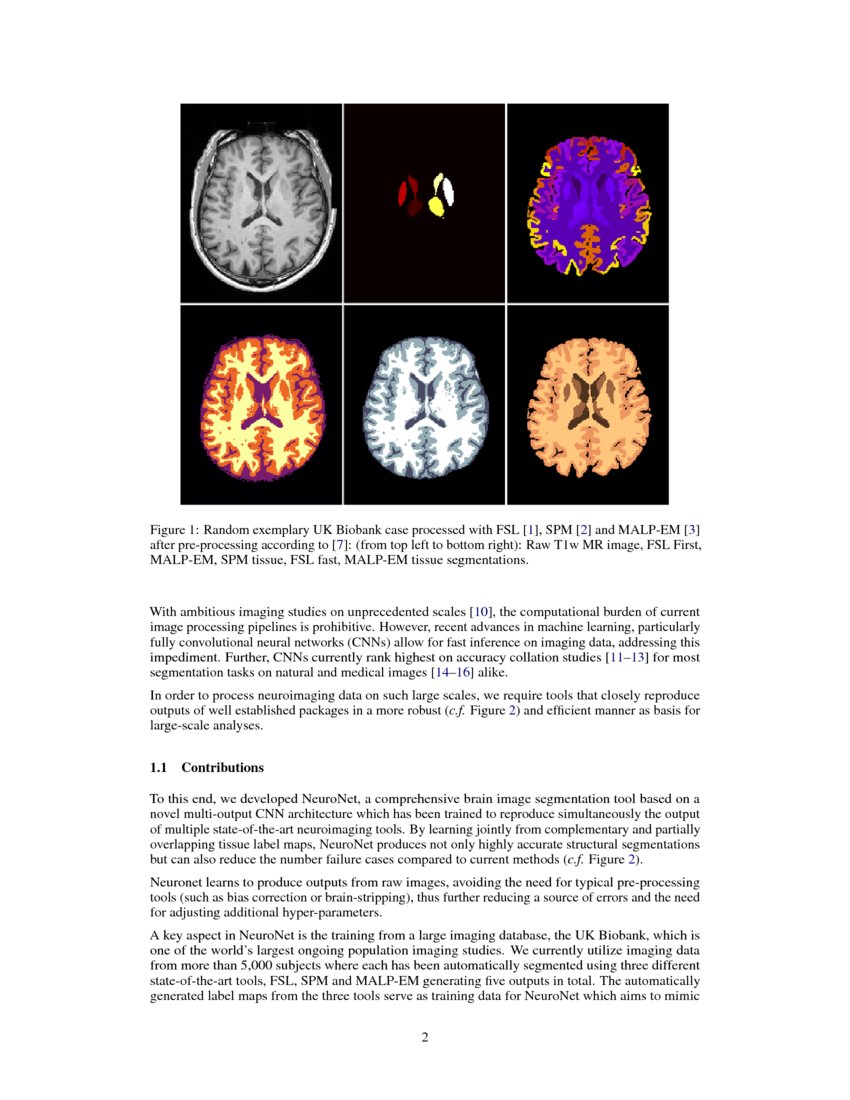 NeuroNet: Fast and Robust Reproduction of Multiple Brain Image Segmentation Pipelines | DeepAI