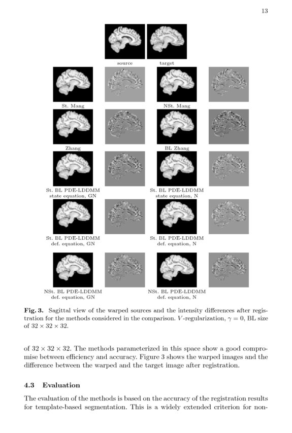 Newton-Krylov PDE-constrained LDDMM in the space of band-limited vector ...