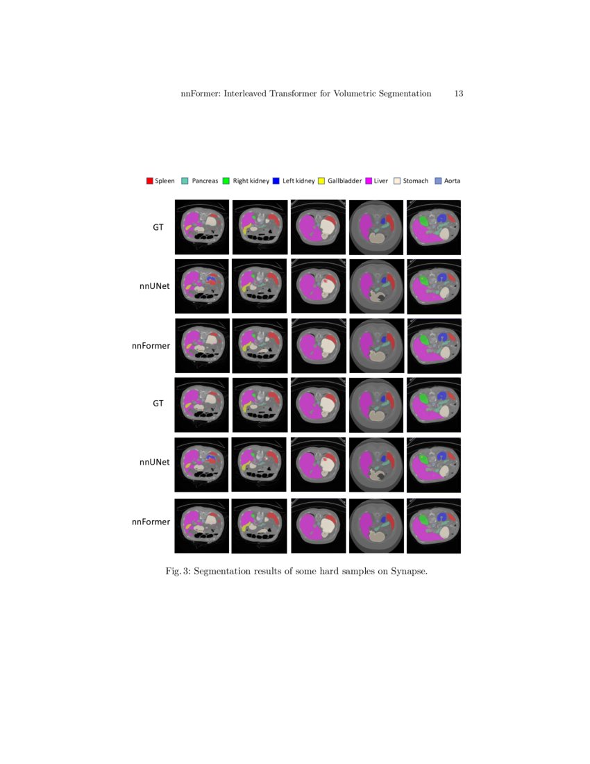 nnFormer: Interleaved Transformer for Volumetric Segmentation | DeepAI