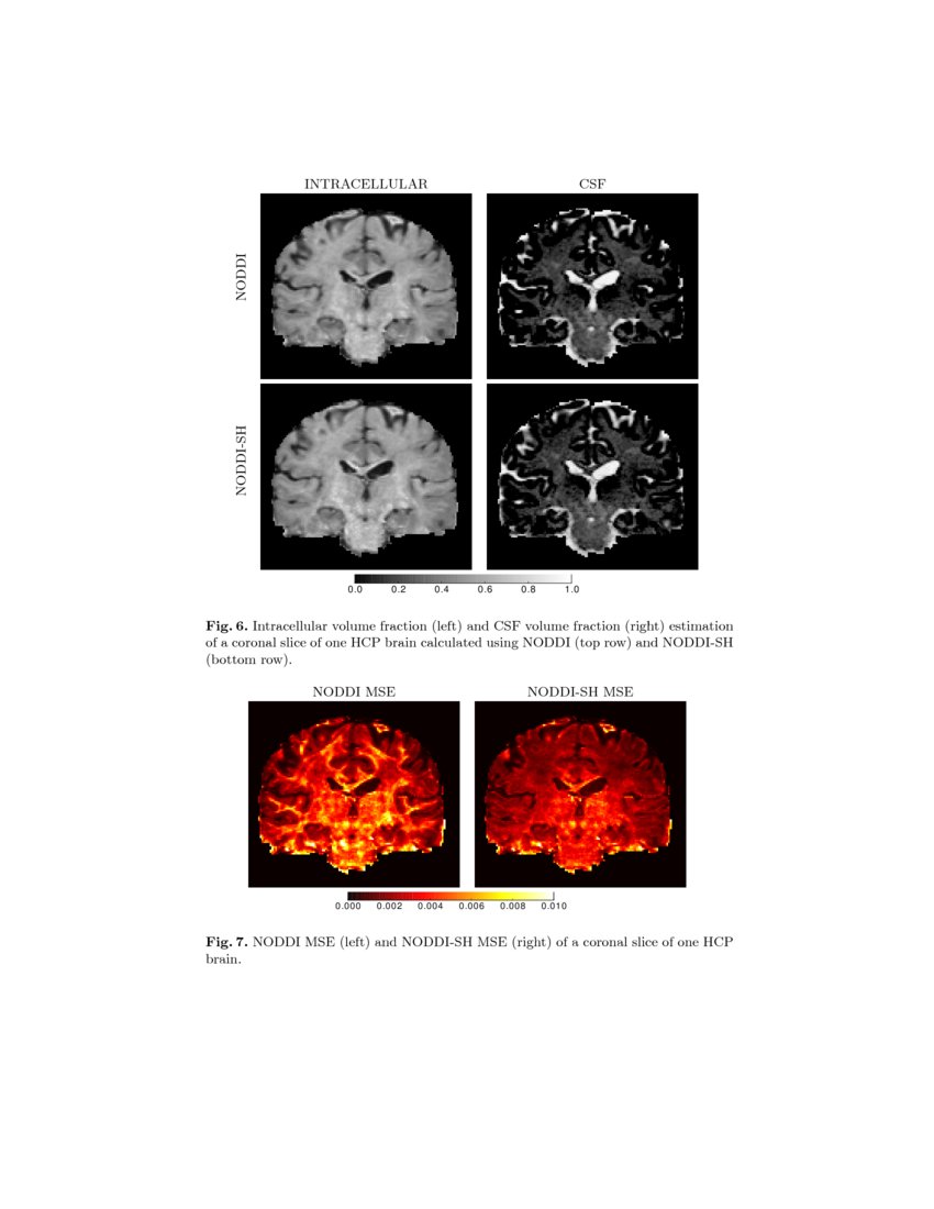 NODDI-SH: a computational efficient NODDI extension for fODF estimation ...
