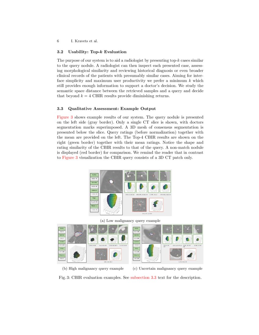 Nodule2vec: a 3D Deep Learning System for Pulmonary Nodule Retrieval ... Nodule2vec: a 3D Deep Learning System for Pulmonary Nodule Retrieval ...