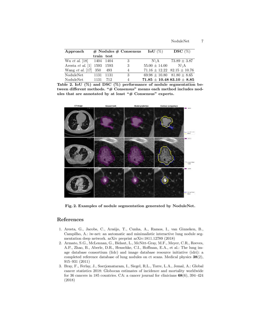 NoduleNet: Decoupled False Positive Reductionfor Pulmonary Nodule ... NoduleNet: Decoupled False Positive Reductionfor Pulmonary Nodule ...