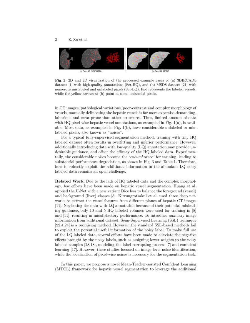 Noisy Labels are Treasure: Mean-Teacher-Assisted Confident Learning for ...