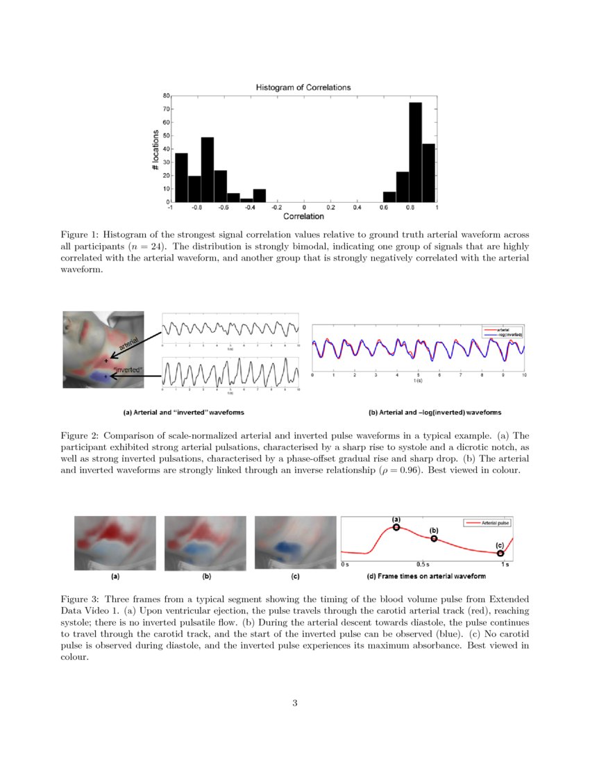 Non-contact hemodynamic imaging reveals the jugular venous pulse ...