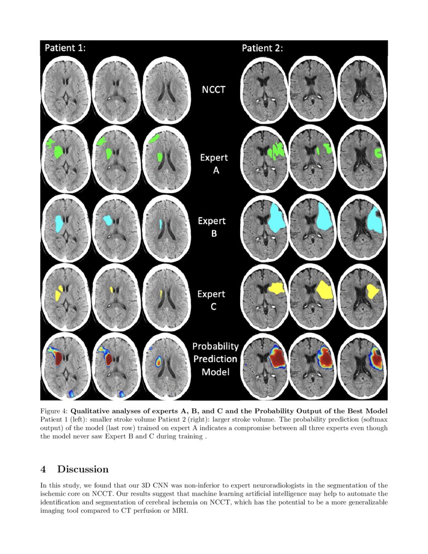 Non Inferiority Of Deep Learning Model To Segment Acute Stroke On Non