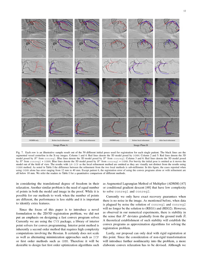 Non Iterative Rigid 2d3d Point Set Registration Using Semidefinite Programming Deepai 4298