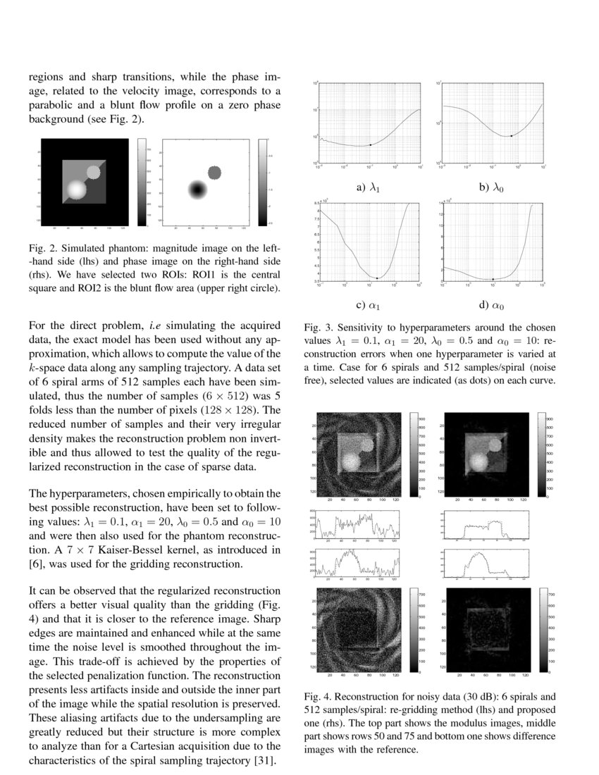 Non Quadratic Convex Regularized Reconstruction Of Mr Images From 0624