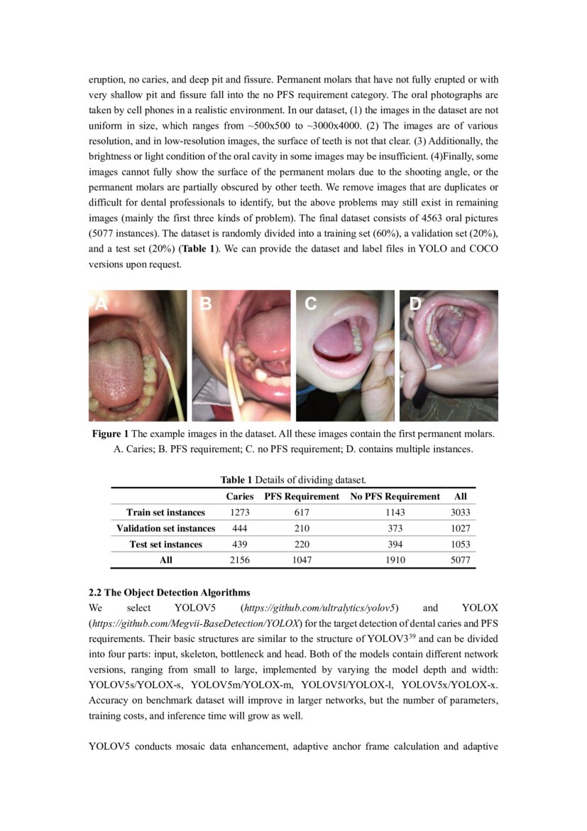 Object Detection For Caries Or Pit And Fissure Sealing Requirement In
