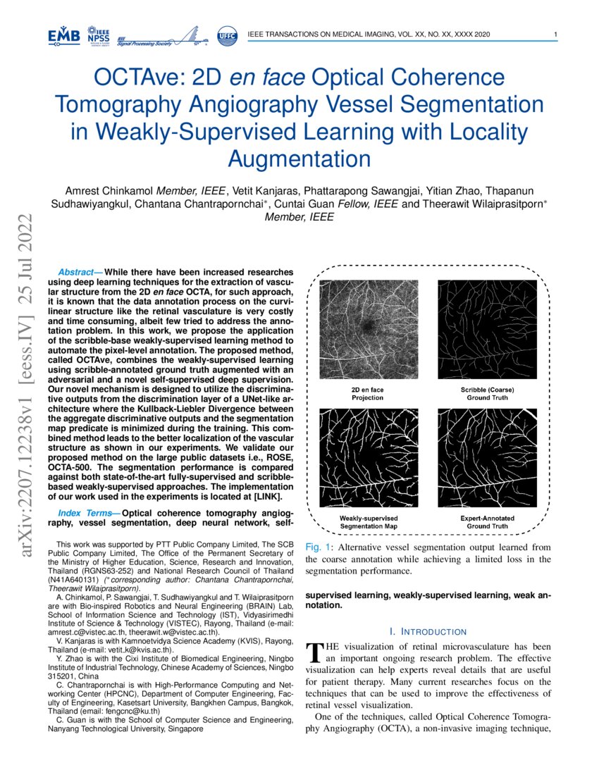 OCTAve: 2D en face Optical Coherence Tomography Angiography Vessel ...