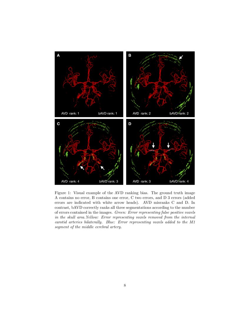 On The Usage Of Average Hausdorff Distance For Segmentation Performance Assessment Hidden Bias