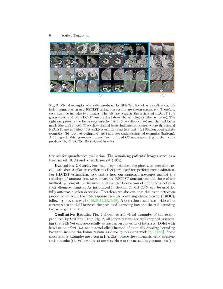 One Click Lesion RECIST Measurement and Segmentation on CT Scans | DeepAI