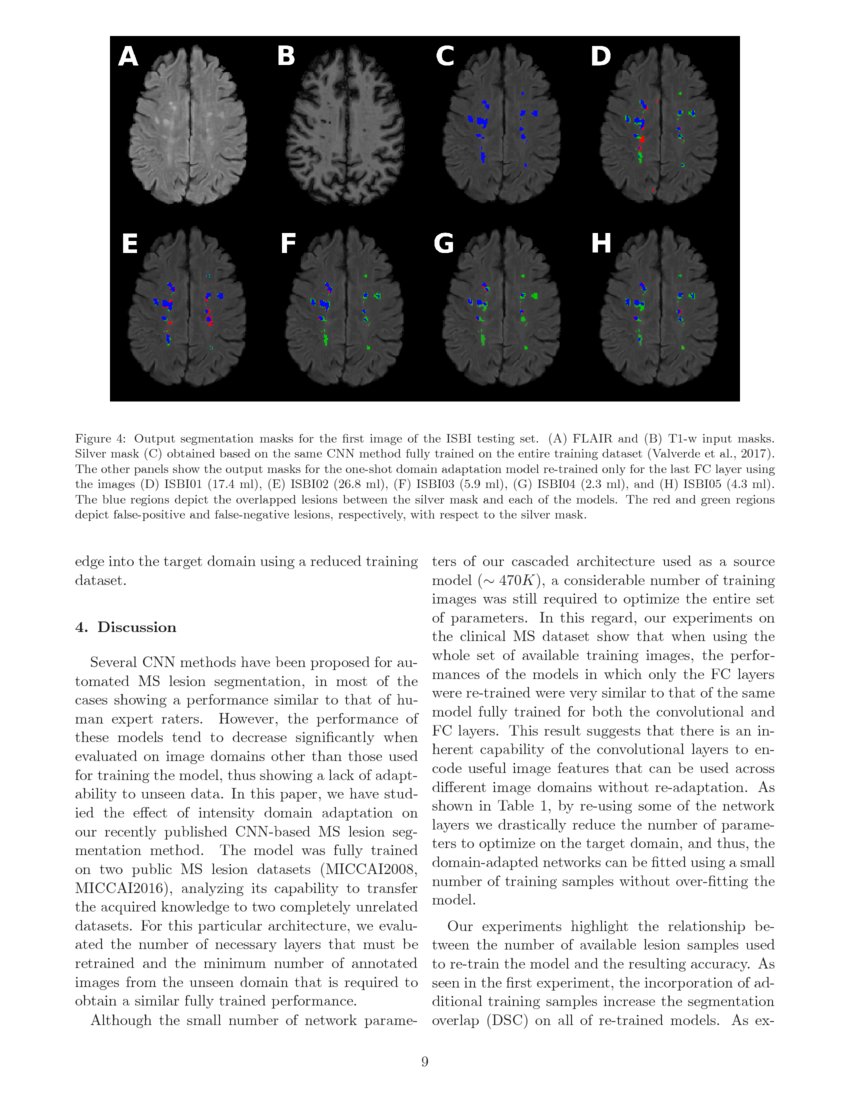 One Shot Domain Adaptation In Multiple Sclerosis Lesion Segmentation Using Convolutional Neural