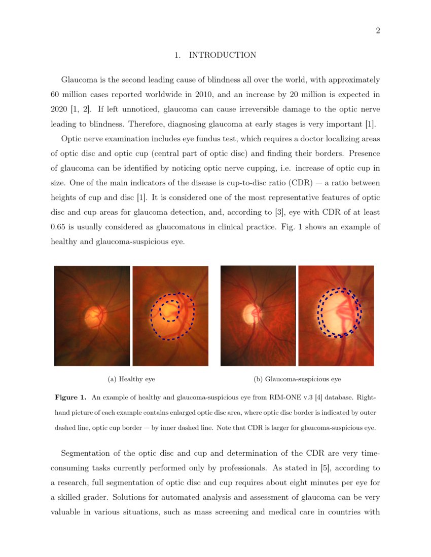 Optic Disc and Cup Segmentation Methods for Glaucoma Detection with Modification of U-Net ...