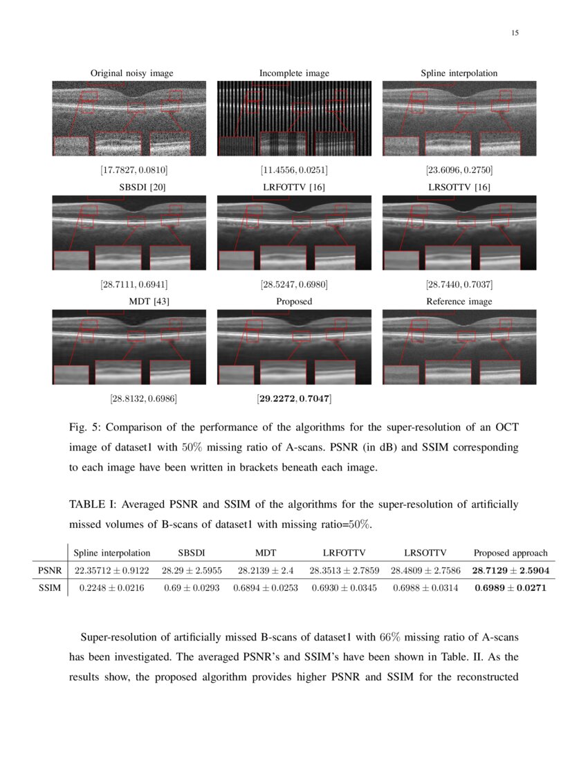 Optical Coherence Tomography Image Enhancement via Block Hankelization and Low Rank Tensor ...