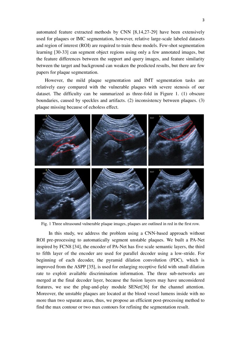 Parallel Network with Channel Attention and Post-Processing for Carotid ...