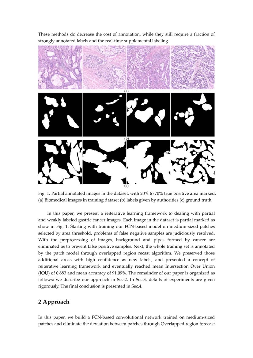 Partial Labeled Gastric Tumor Segmentation via patch-based Reiterative Learning | DeepAI