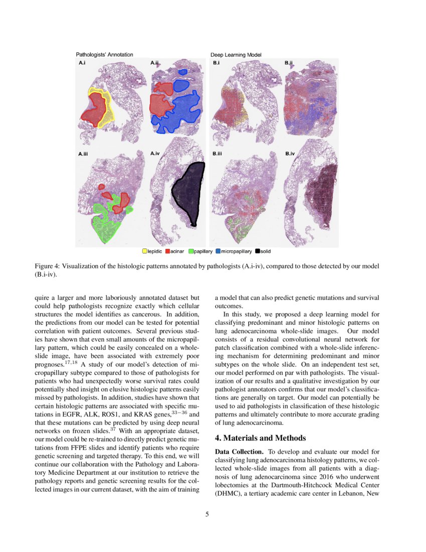 Pathologist-level classification of histologic patterns on resected ...
