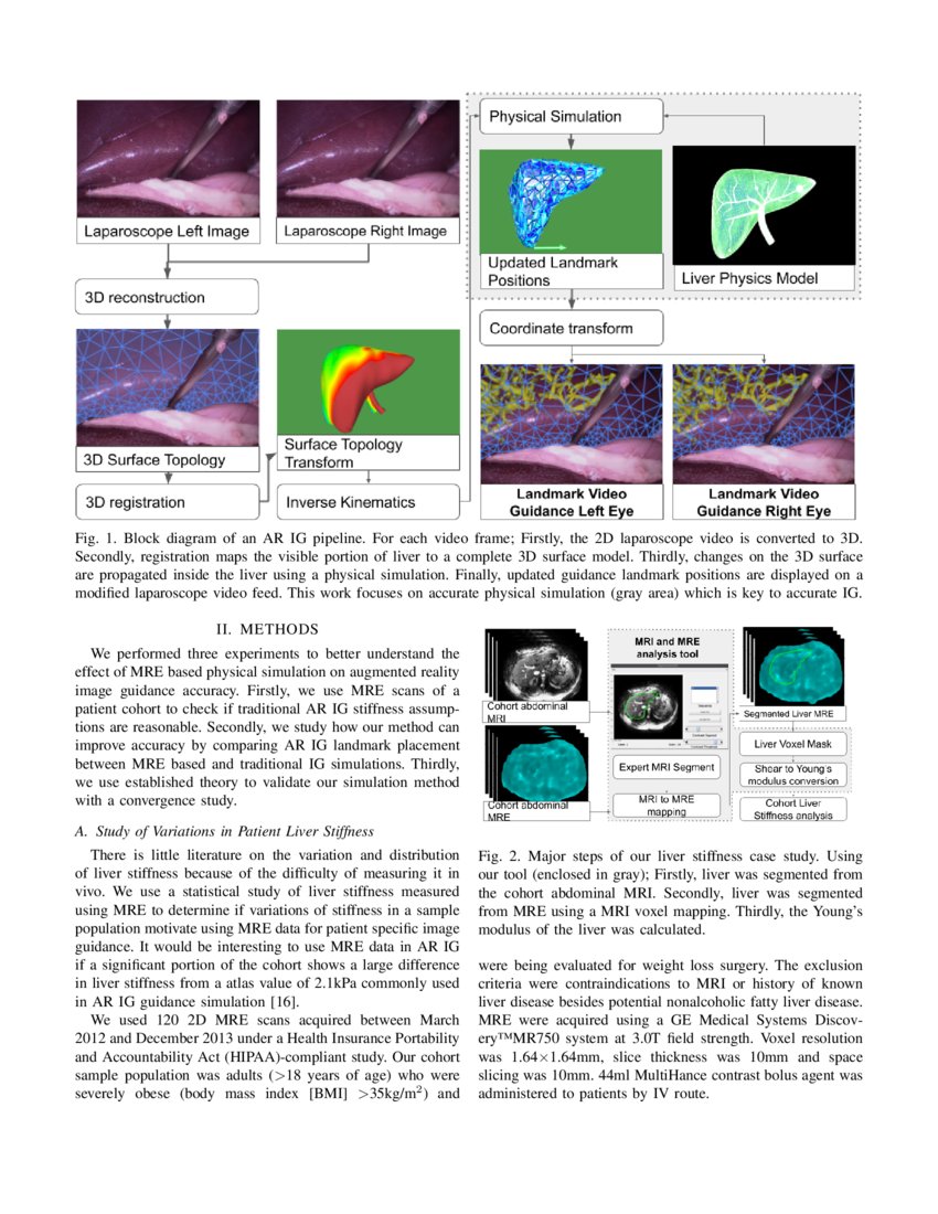 Patient Specific Biomechanics Are Clinically Significant In Accurate ...