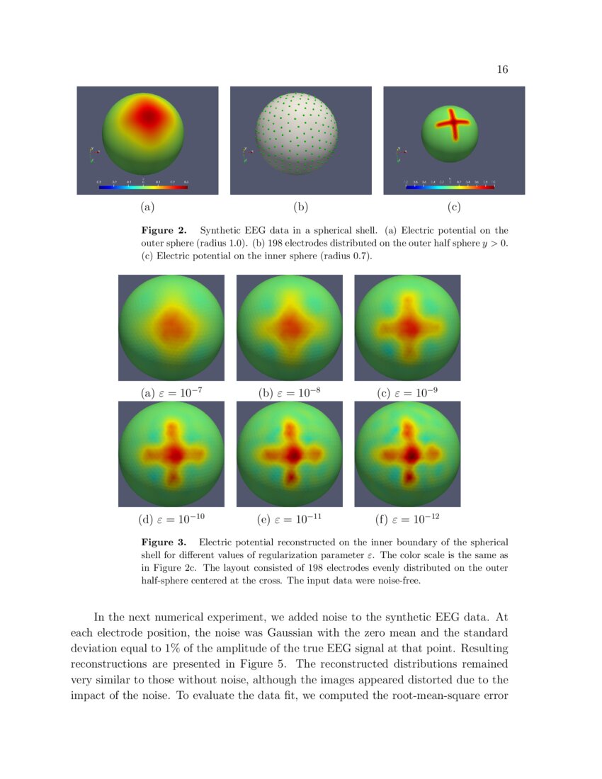 PDE-constrained optimization for electroencephalographic source reconstruction | DeepAI