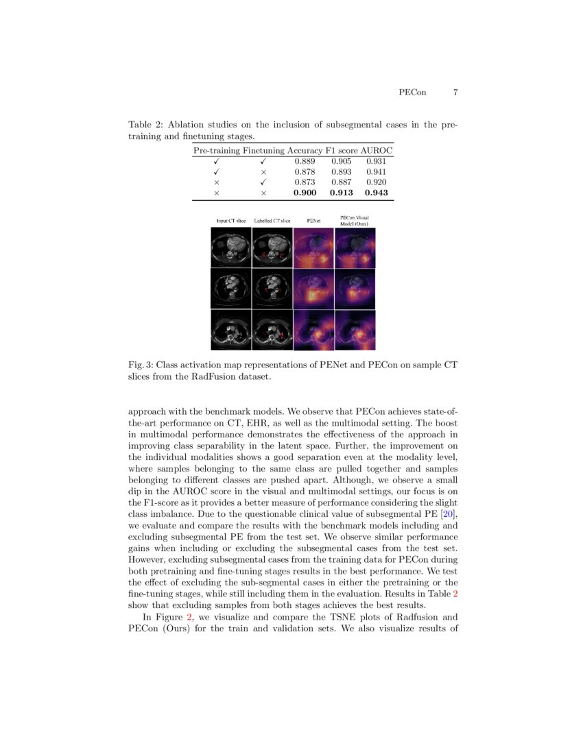 PECon: Contrastive Pretraining to Enhance Feature Alignment between CT ...