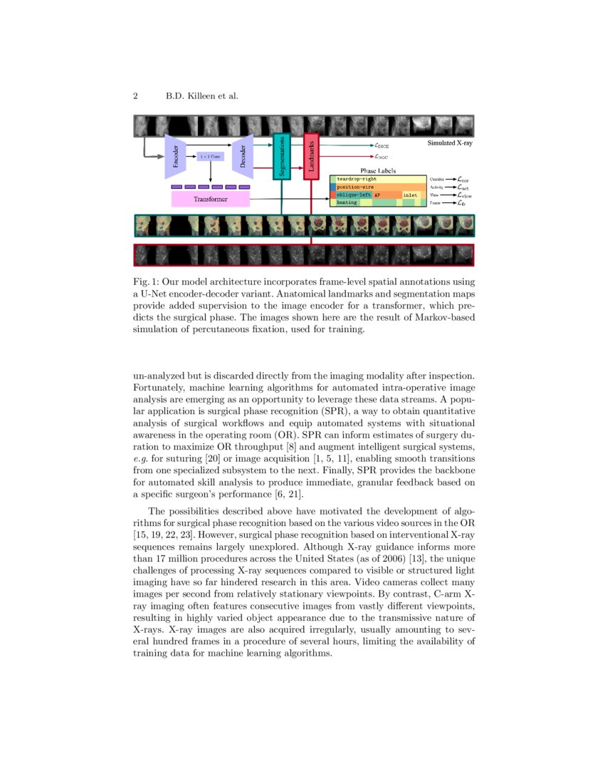 Pelphix: Surgical Phase Recognition from X-ray Images in Percutaneous ...