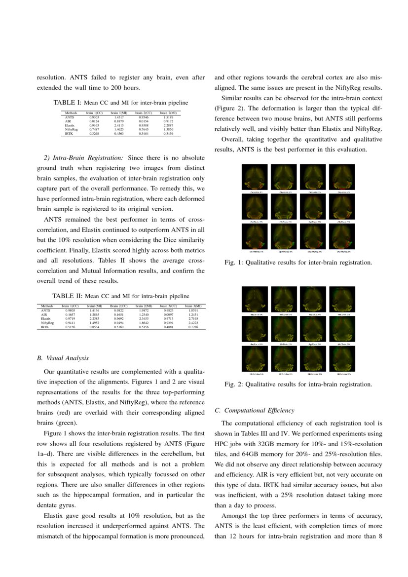 Performance of Image Registration Tools on High-Resolution 3D Brain ...
