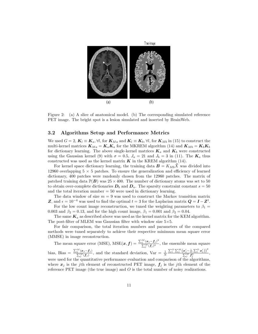 PET Image Reconstruction with Multiple Kernels and Multiple Kernel Space Regularizers | DeepAI