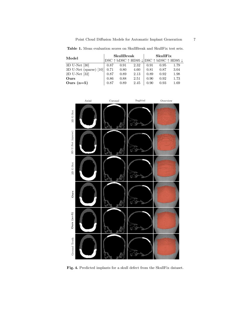Point Cloud Diffusion Models for Automatic Implant Generation | DeepAI