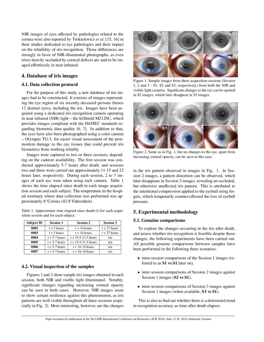 Post-mortem Human Iris Recognition | DeepAI
