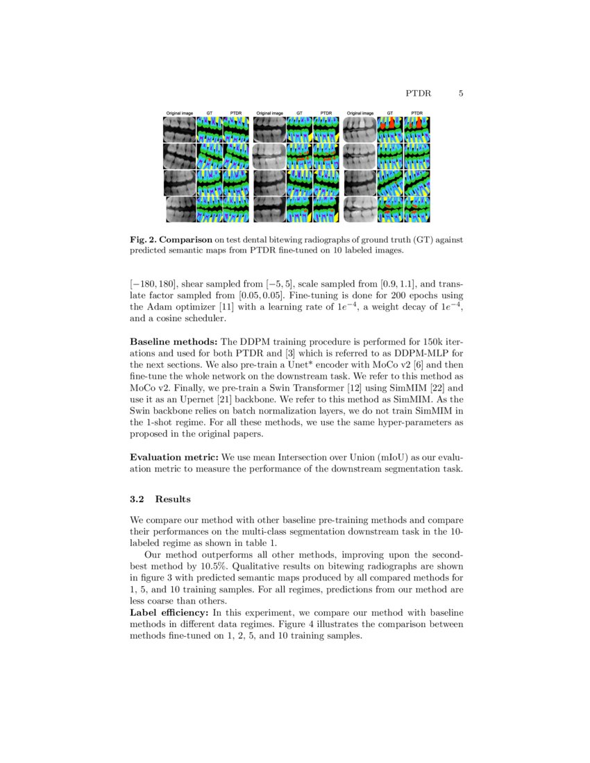 Pre-Training with Diffusion models for Dental Radiography segmentation ... Pre-Training with Diffusion models for Dental Radiography segmentation ...
