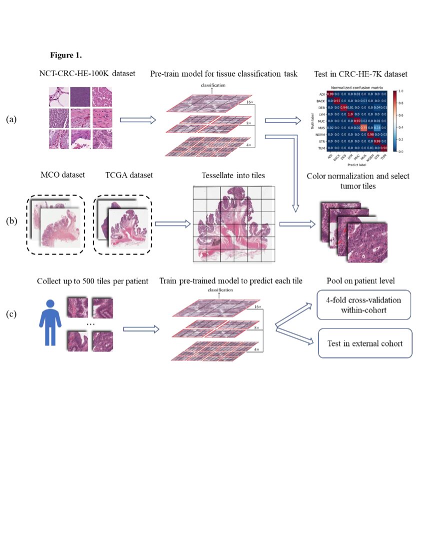 Predicting microsatellite instability and key biomarkers in colorectal cancer from H E-stained ...