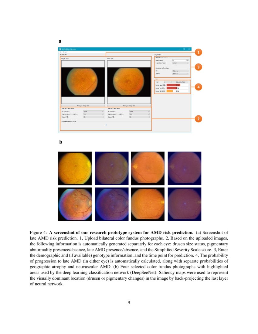 Predicting Risk Of Late Age Related Macular Degeneration Using Deep Learning Deepai