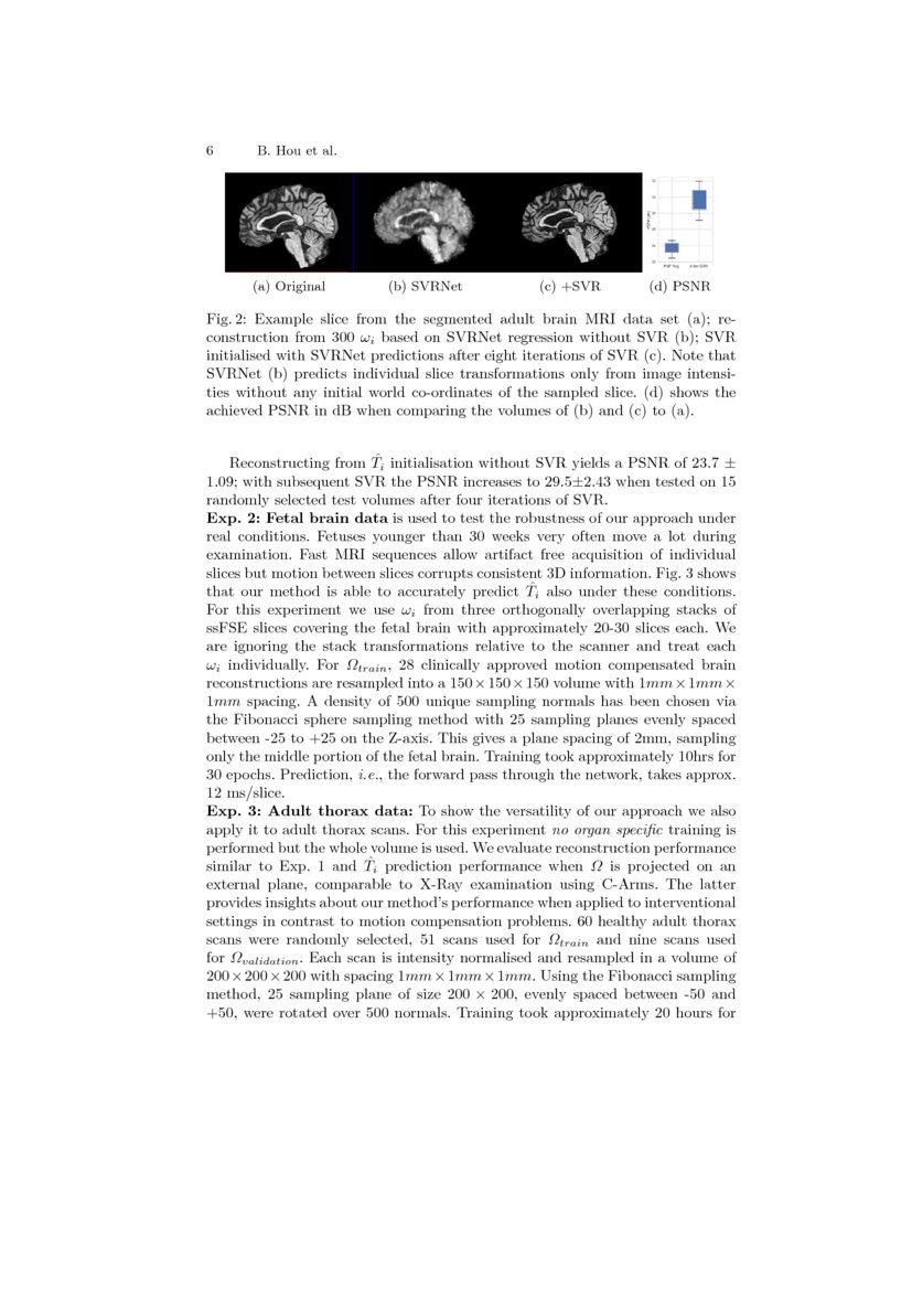 Predicting Slice To Volume Transformation In Presence Of Arbitrary
