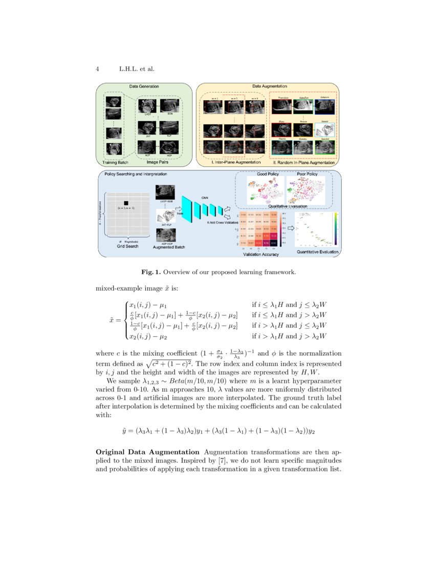 Principled Ultrasound Data Augmentation for Classification of Standard Planes | DeepAI