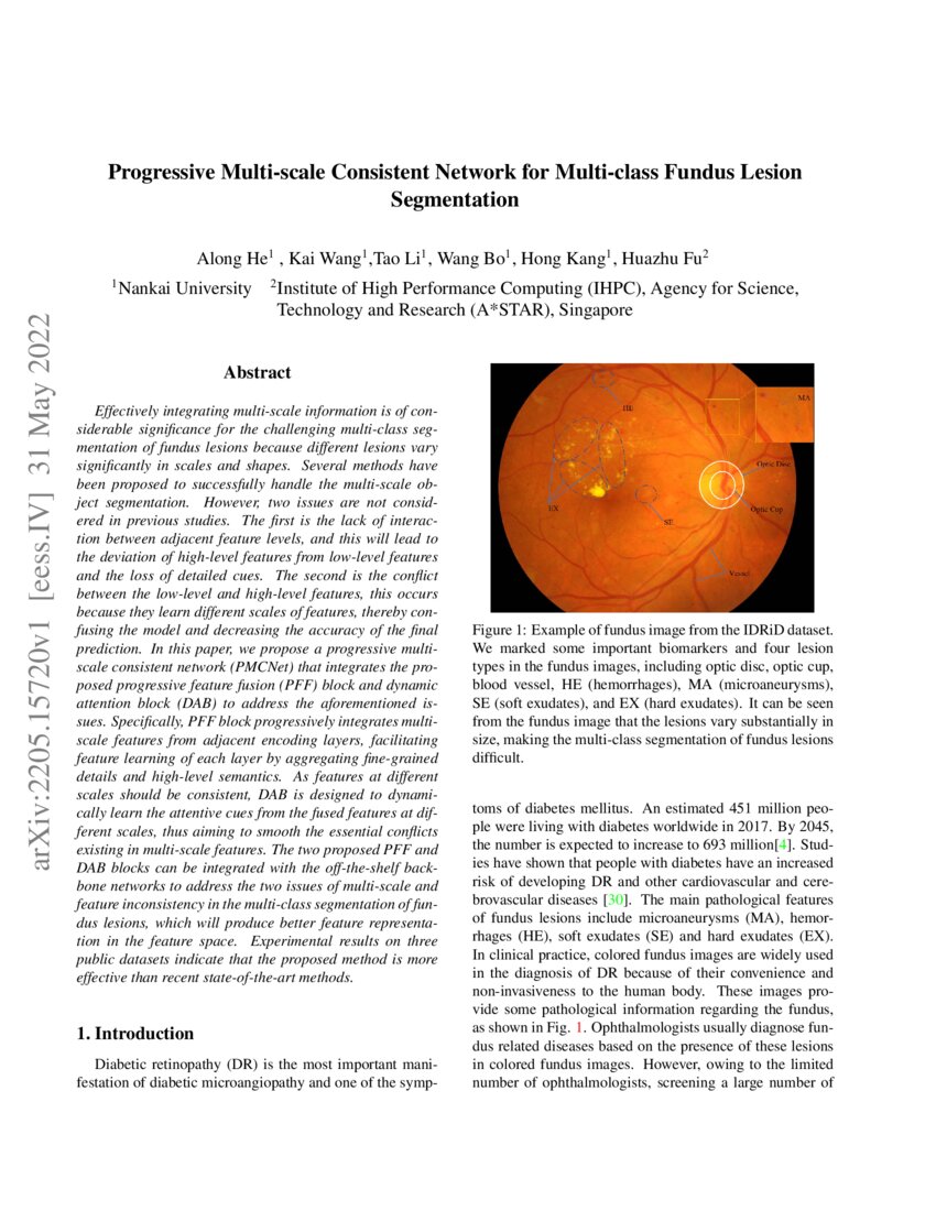 Progressive Multi-scale Consistent Network for Multi-class Fundus ...