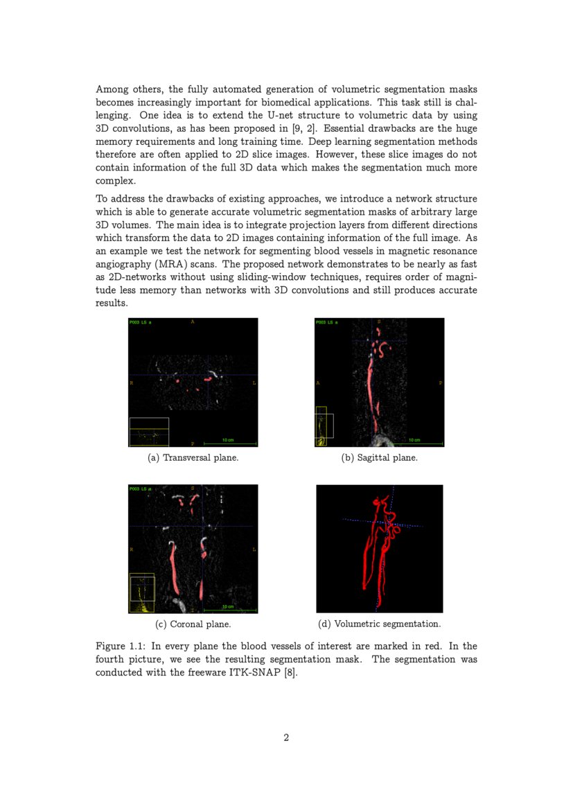 Projection-Based 2.5D U-net Architecture for Fast Volumetric ...
