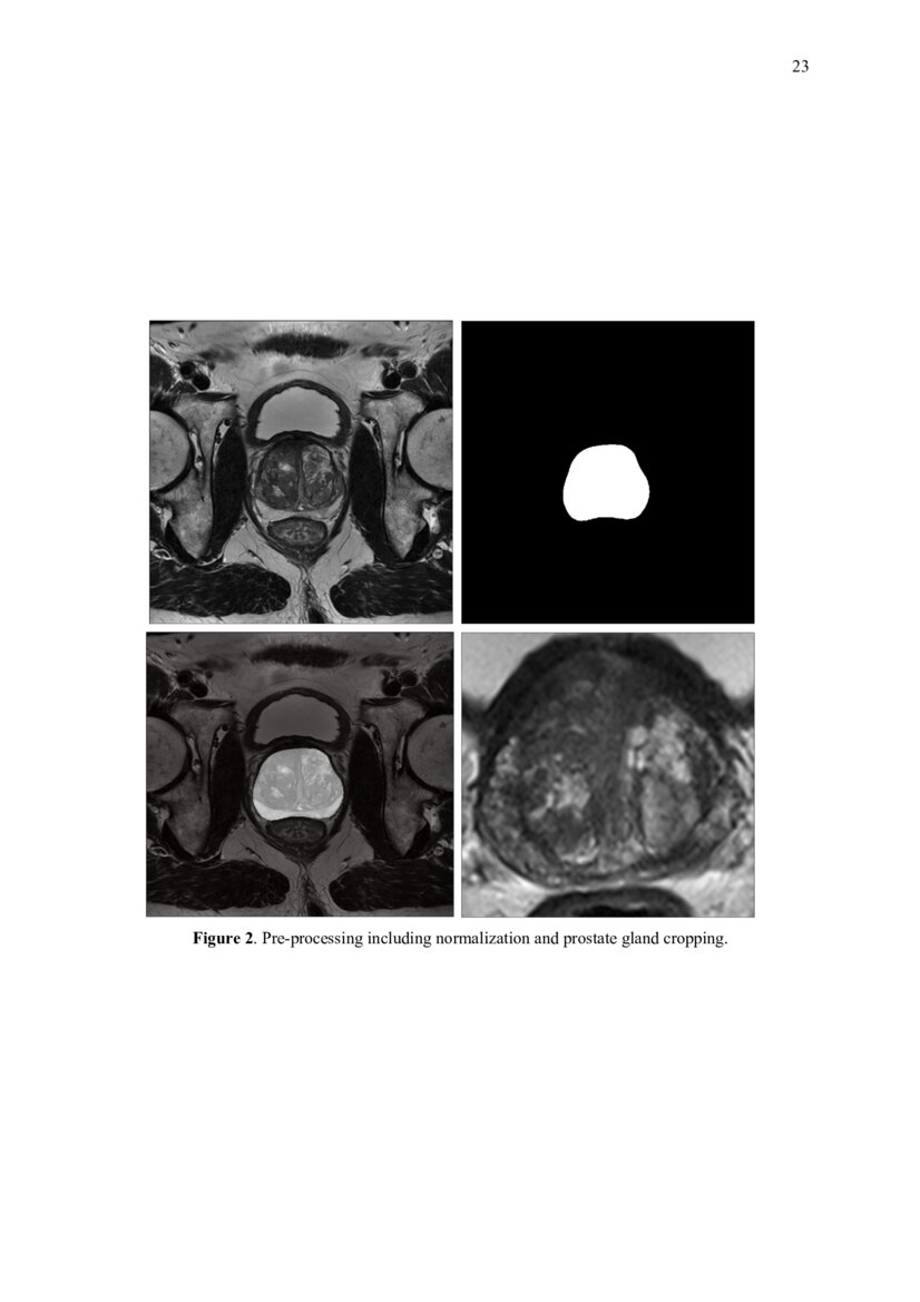 Prostate Age Gap (PAG): An MRI surrogate marker of aging for prostate ...