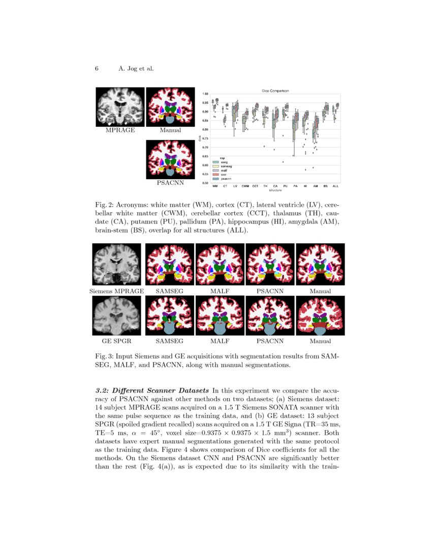 Pulse Sequence Resilient Fast Brain Segmentation | DeepAI